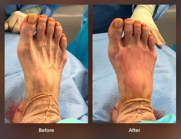 Sports Medicine | Boca Raton Foot Care