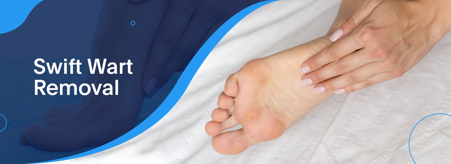 Swift Wart Removal - Boca Raton | Boynton Beach Foot Doctors